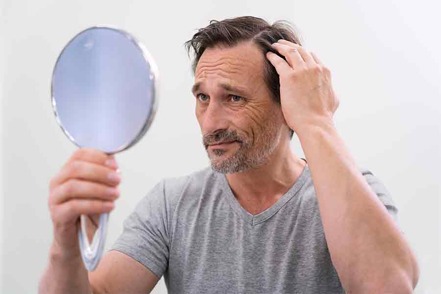 Mens Hair Loss When To Start Treatment - Este Pearl